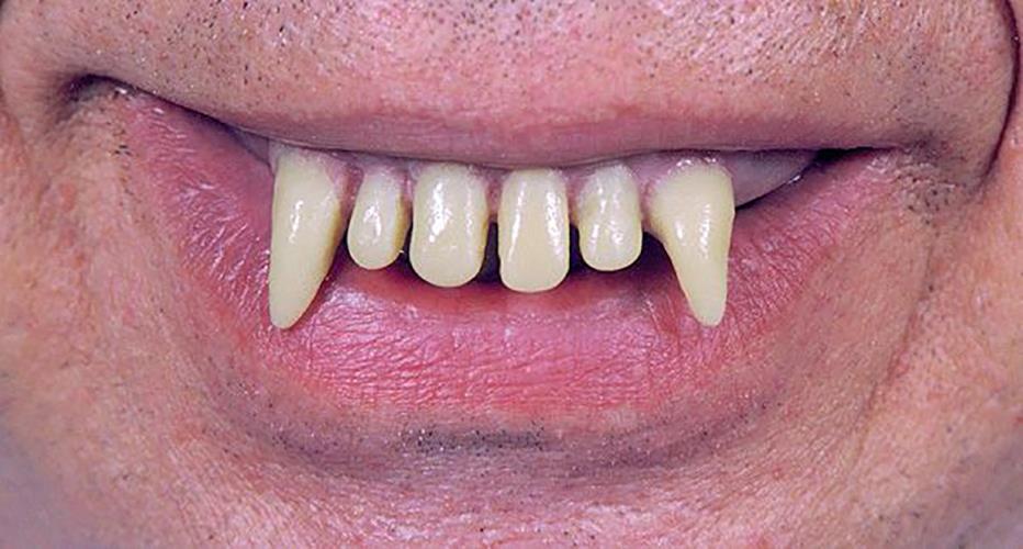 Ghoulio Wacky Glow Teeth Adult Costume Accessory - Fashion For Fun